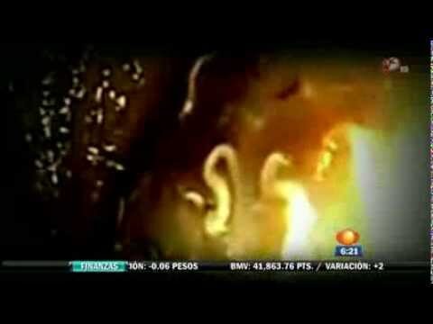 Parásito lombriz en el estómago: síntomas y tratamiento | Actualizado ...